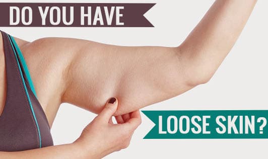 Do You Have Loose Skin? - The Wellness Corner